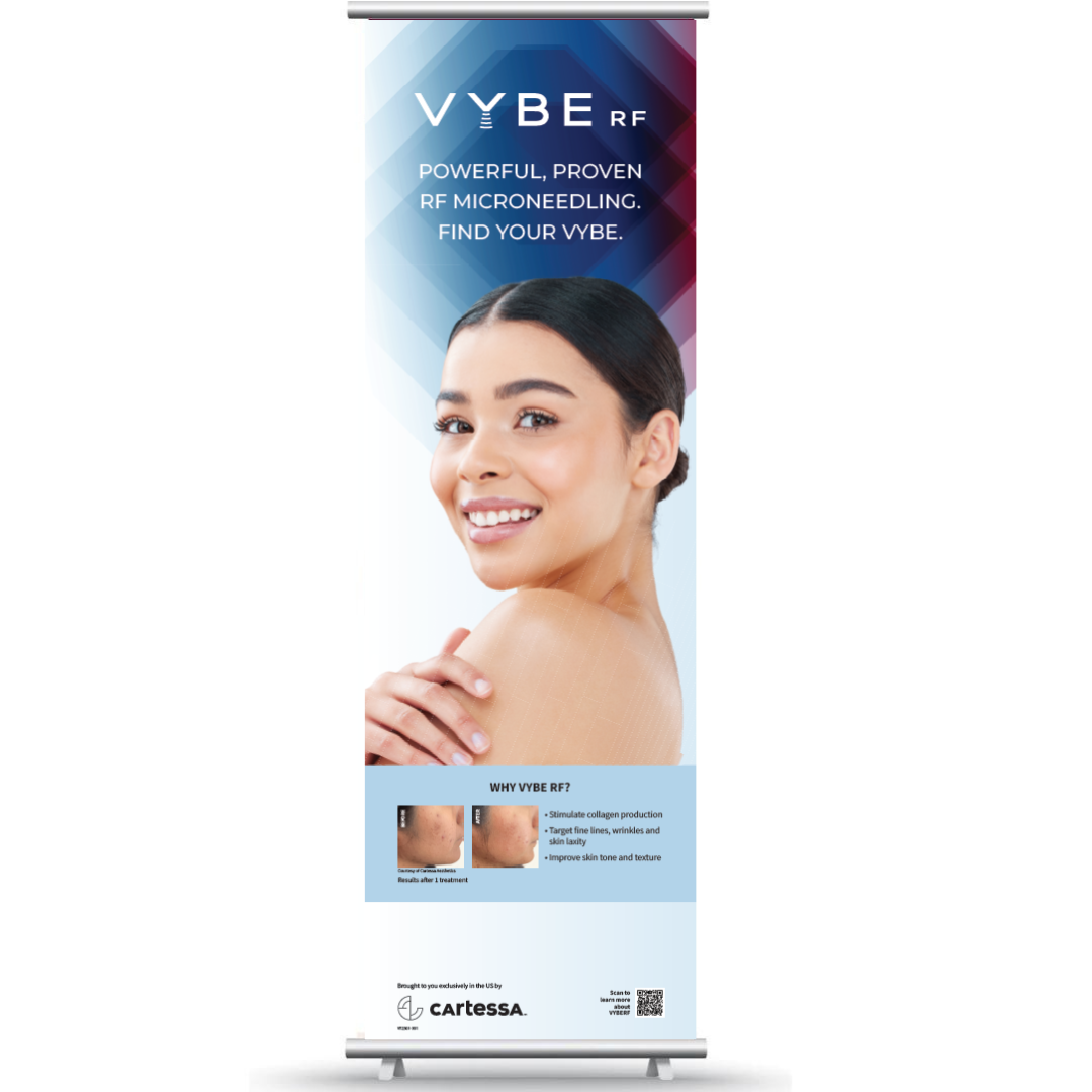 VybeRF Pop-up Banner